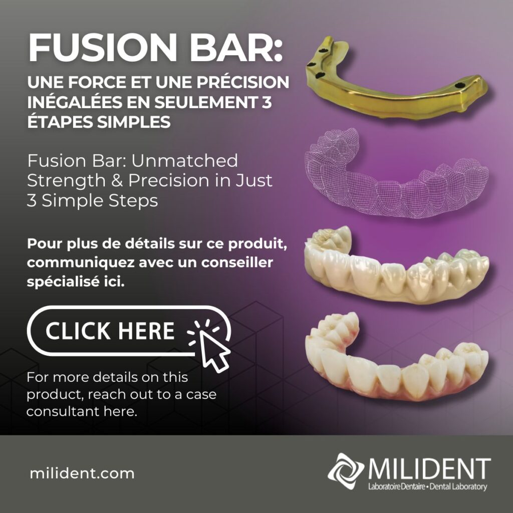 Fusion Bar - Milident
